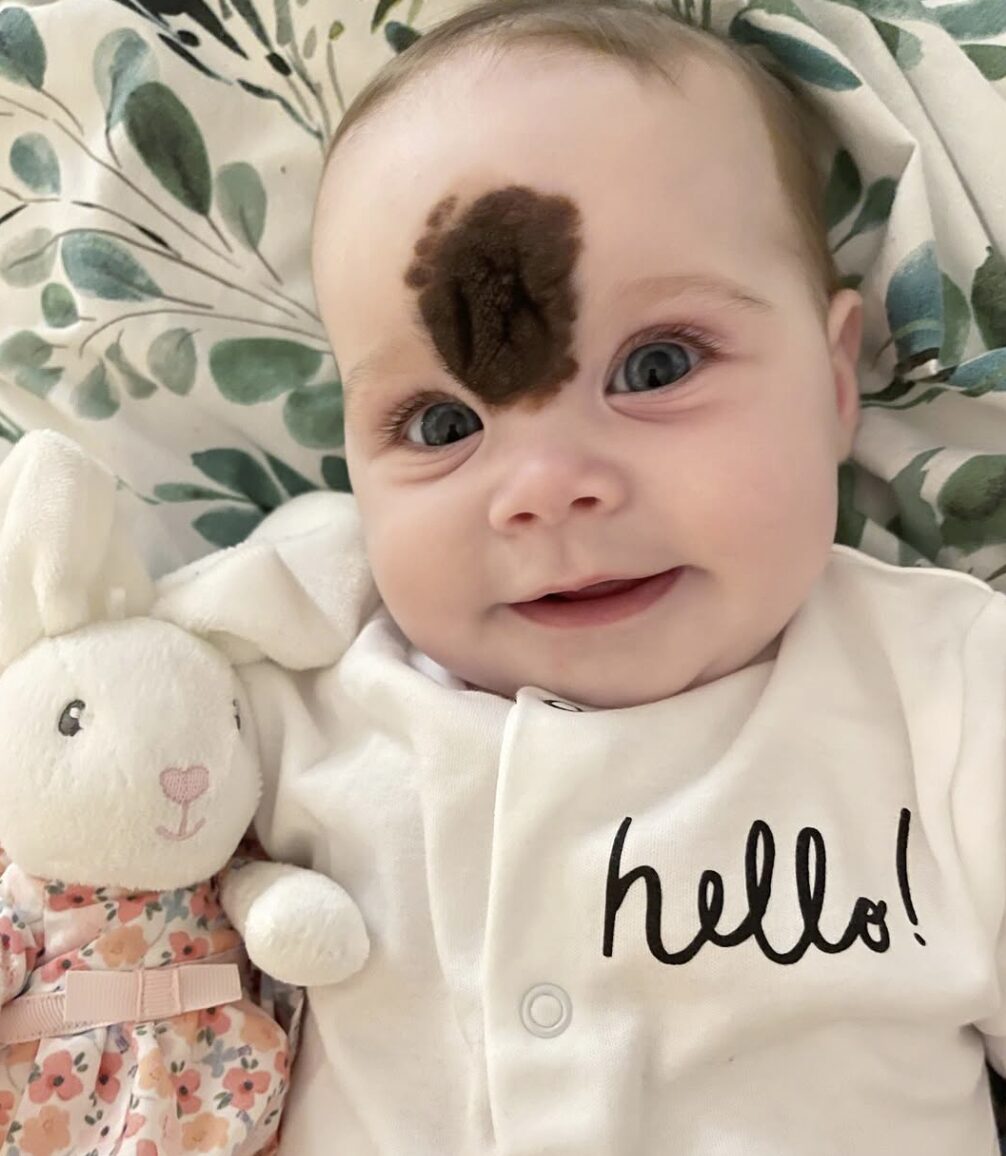 Cruel stares pushed these parents to a tough choice – now their little ...